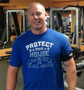 Forward Head Posture